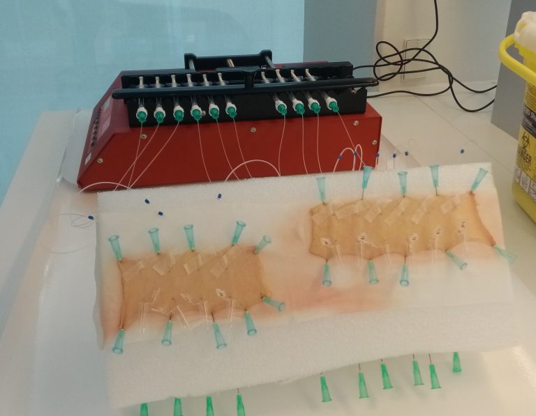 Skin Microdialysis - RefLab ApS
