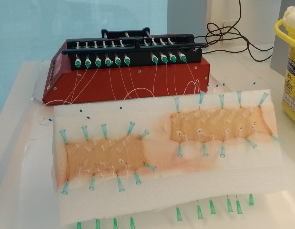 Skin Microdialysis - RefLab ApS