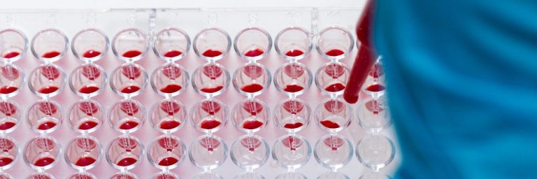 RefLab ApS - CRO, Allergy and Urticaria Testing Laboratory